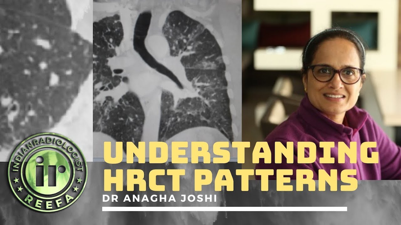 Understanding Lung HRCT patterns | Dr Anagha Joshi | Nodules & Septal ...