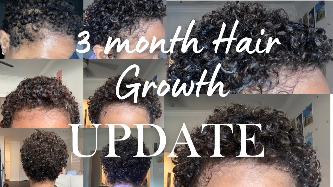 3 month Hair growth update - YouTube
