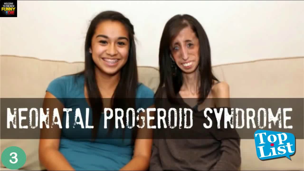 10 Shocking Bizarre Medical Conditions - Part 2 - YouTube