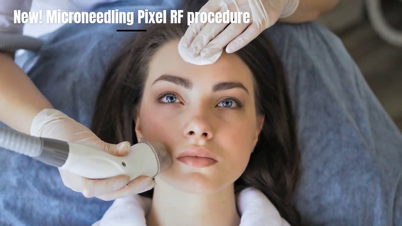 RF Microneedling in Scottsdale | PiXel8-RF at Ultra Smooth Skin - YouTube