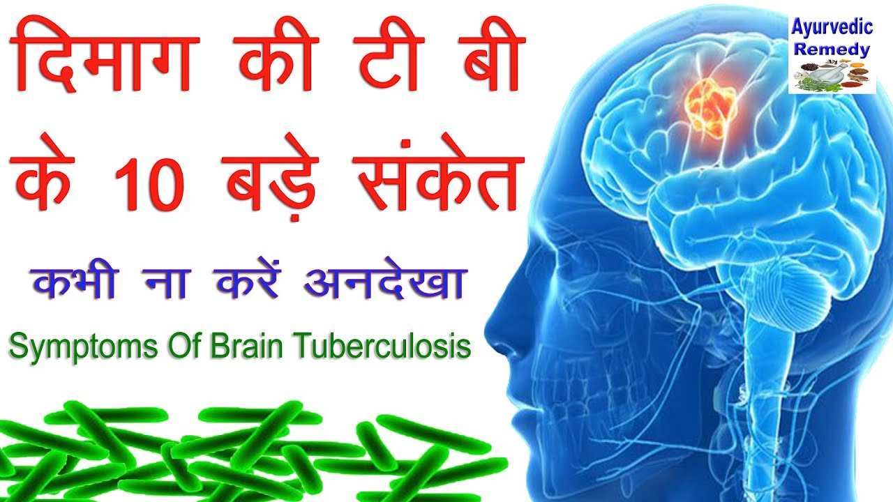 ब्रेन टीबी के लक्षण | tb | tb symptoms | brain tb | symptoms of brain ...