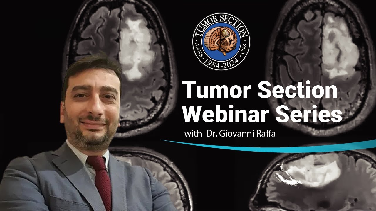 Preoperative Brain Mapping & Neuromodulation of Brain Tumors in ...