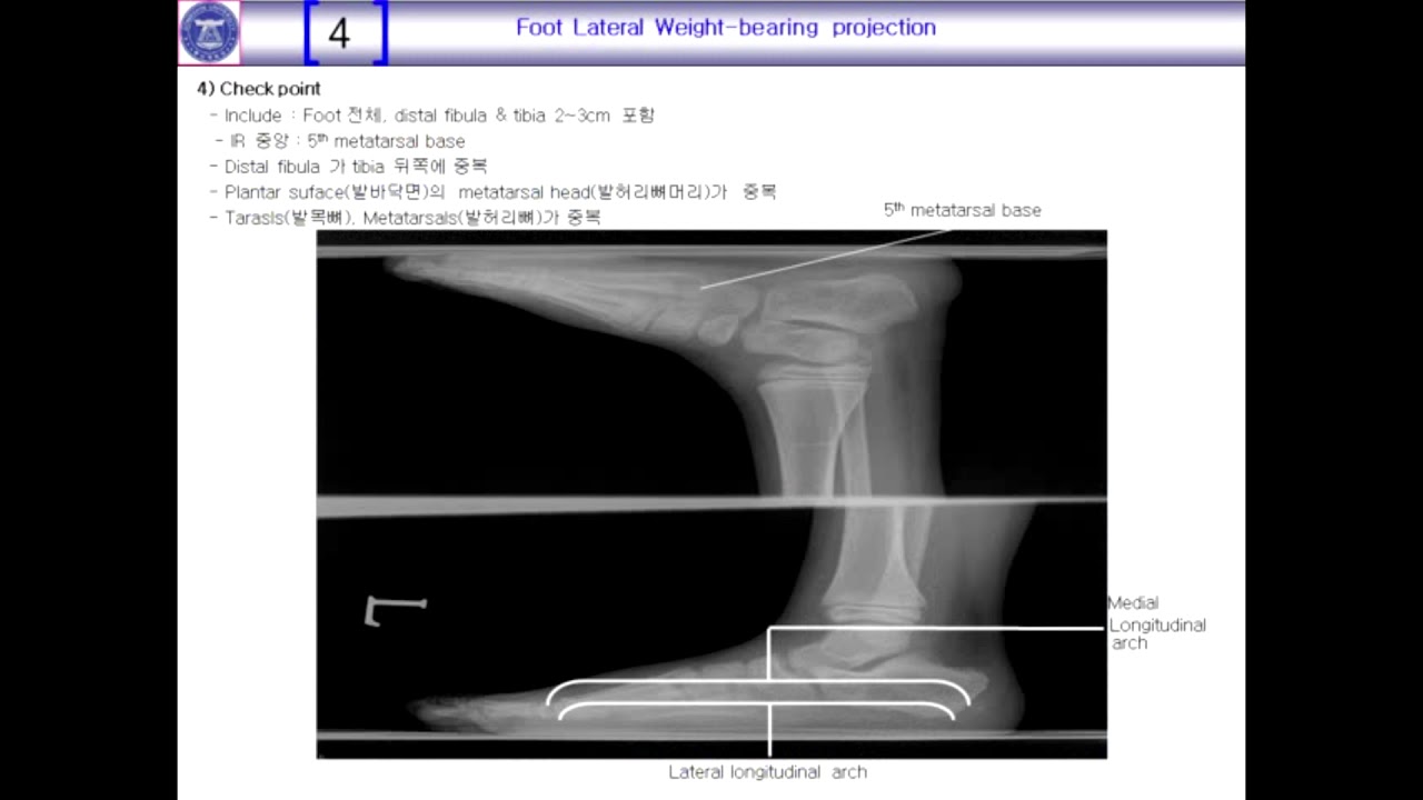 Lower Limb - 10주차 - YouTube