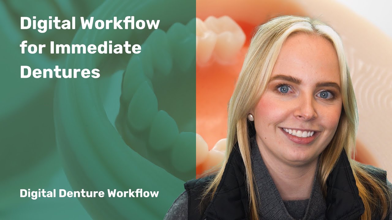 Digital Denture Workflow: Digital Workflow For Immediate Dentures - YouTube