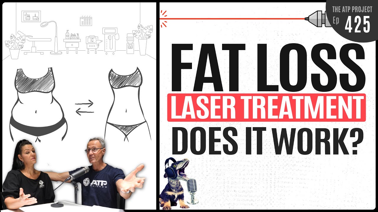 Fat Loss Laser Treatment - Does It Work? | The ATP Project 425 - YouTube