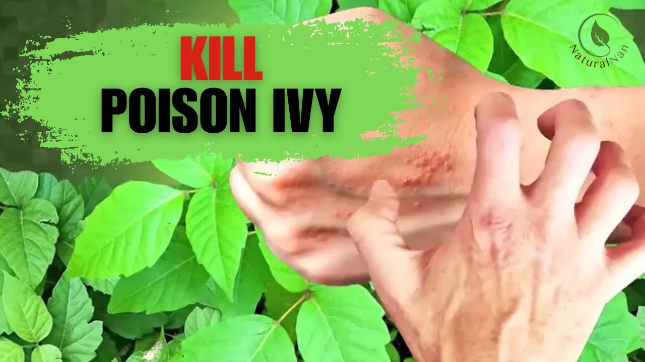 The Ultimate Guide to Natural Poison Ivy Removal - YouTube