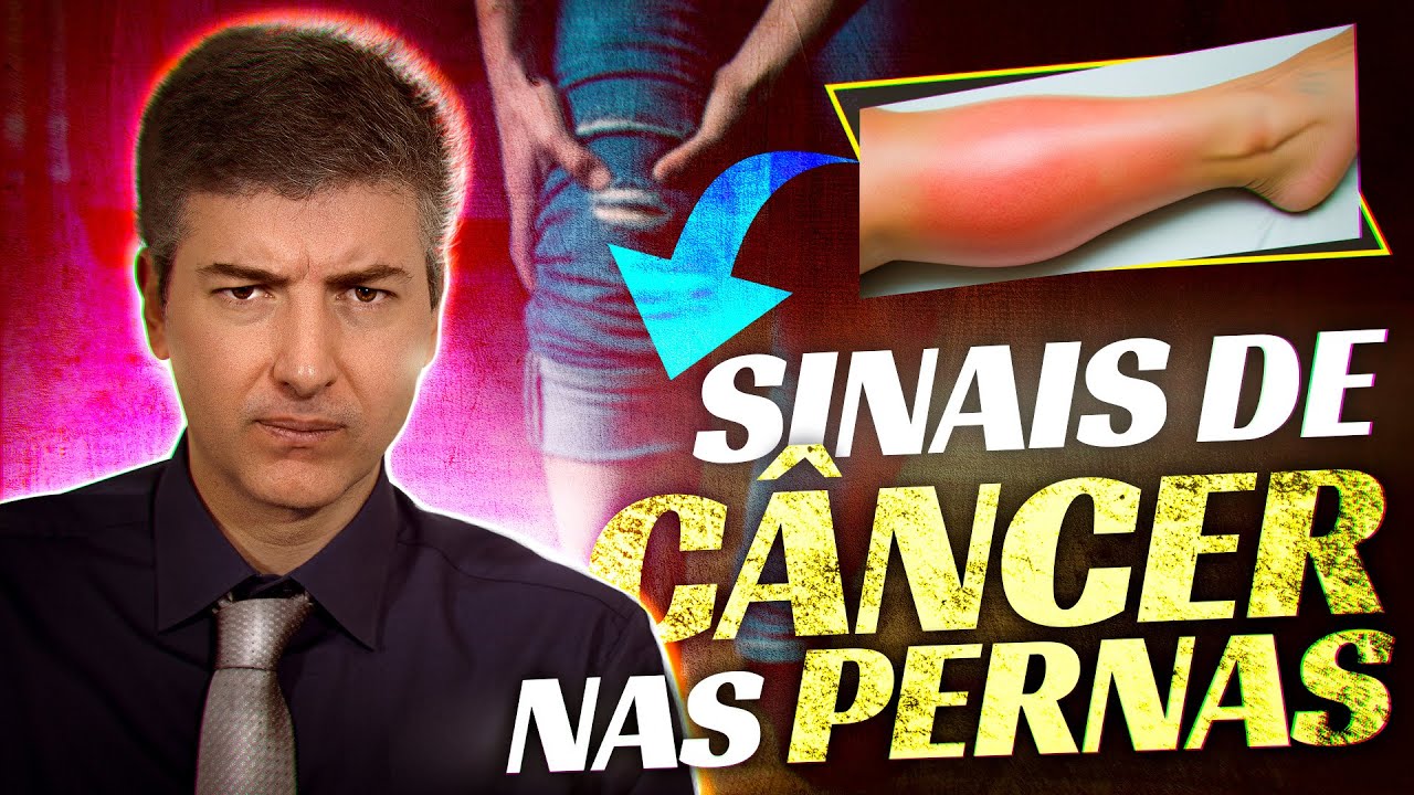 Câncer nas pernas: 7 sinais que toda mulher deve conhecer para agir a ...