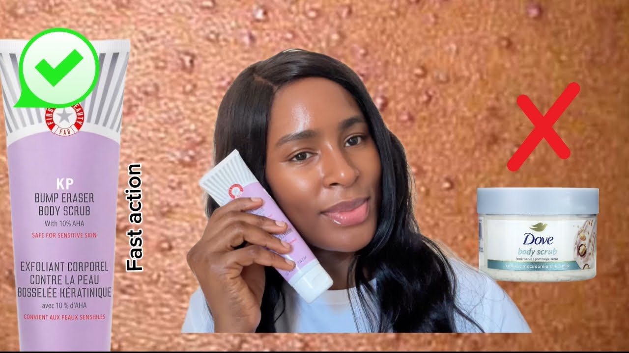 How to Get Rid of Bumpy Skin FAST! Product & Routine that works (body ...