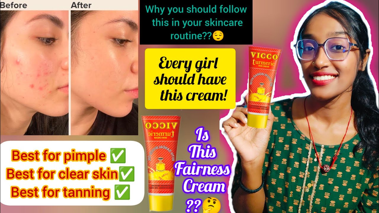 Vicco Turmeric Cream Worth It Or Not? | Review & Demo | Saloni | # ...