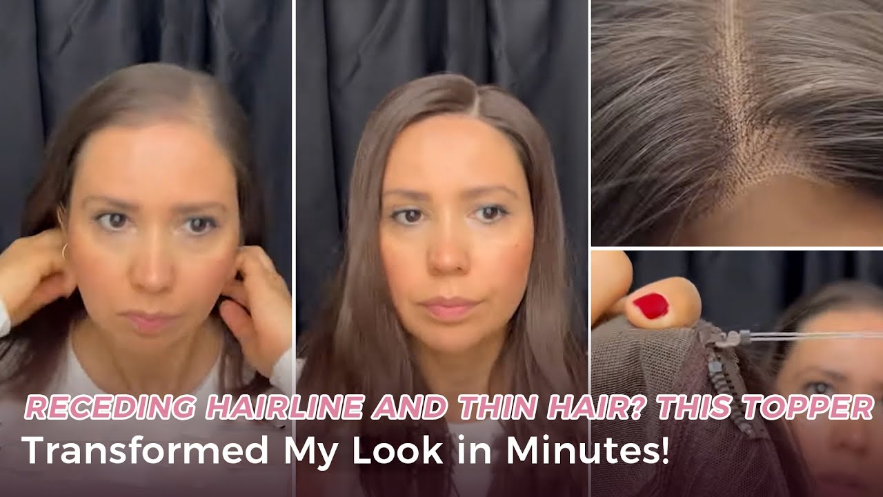 Receding Hairline and Thin Hair? This Topper Transformed My Look in ...