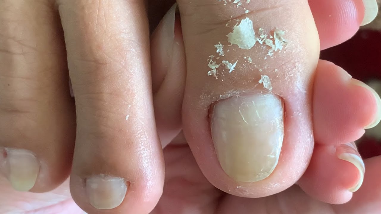 Deep Nail Cleaning - Time to Relax with Nails - Toenail Cleaning ...