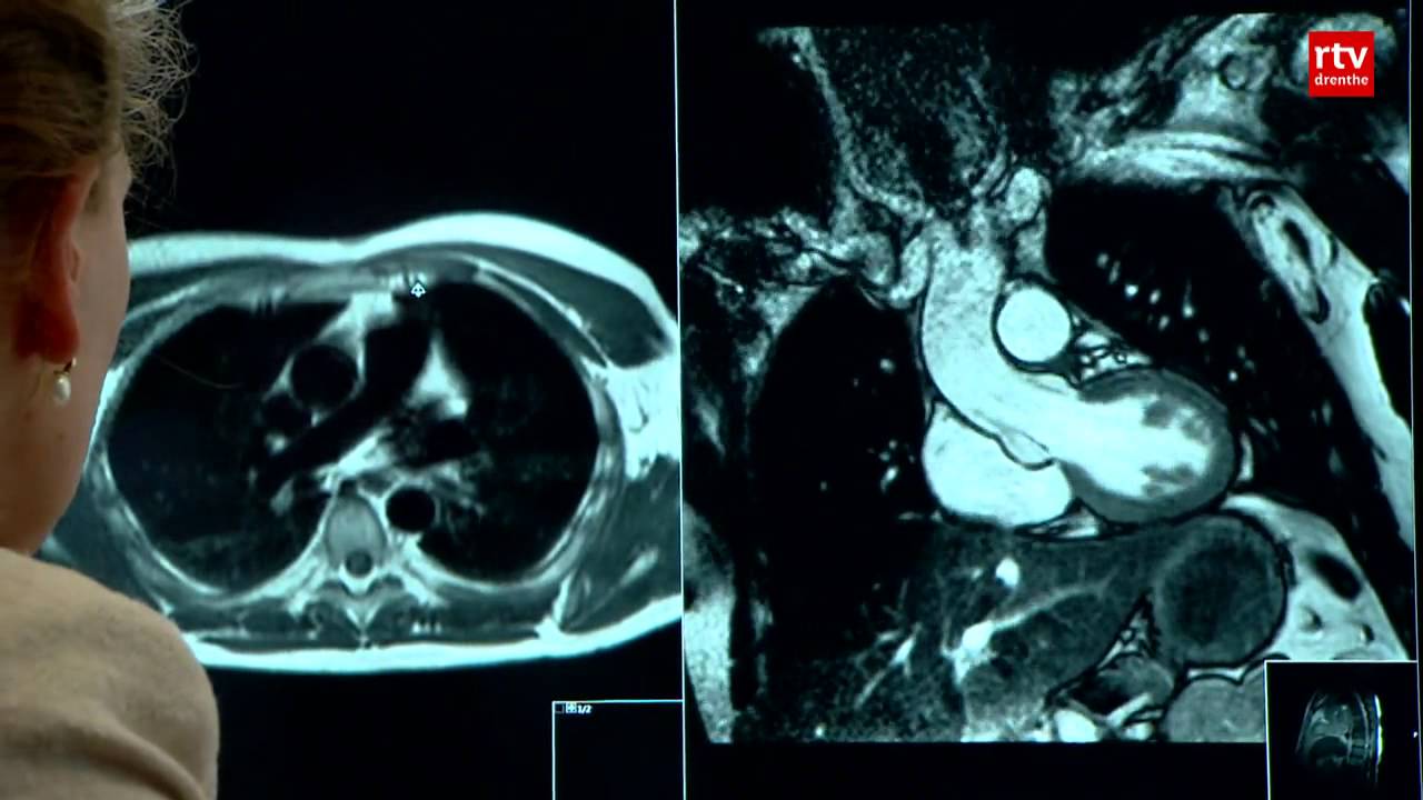 Hart-MRI maakt van ziekenhuis Bethesda hartzorgcentrum - YouTube