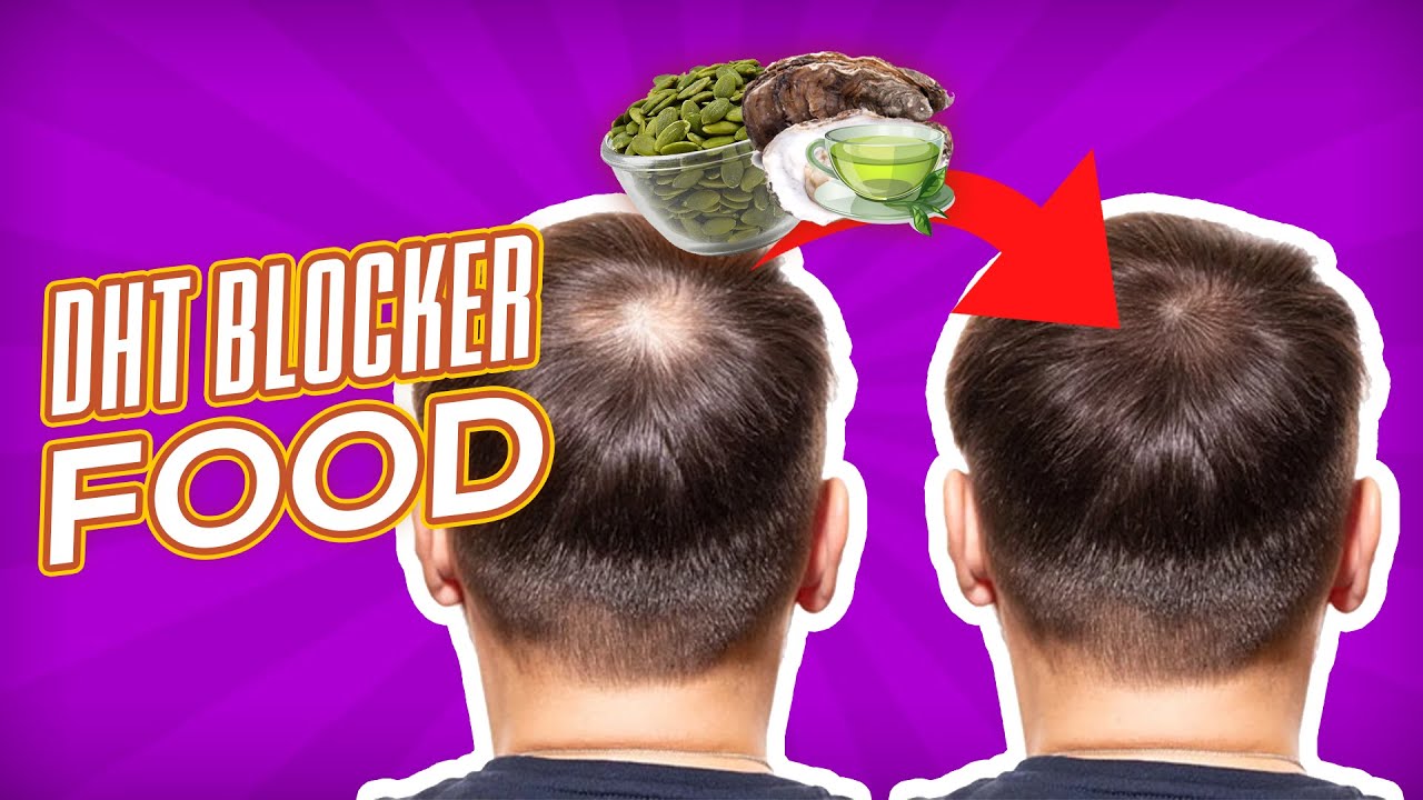 Combat Hair Loss Naturally: DHT Blocking Foods & Supplements Explained ...