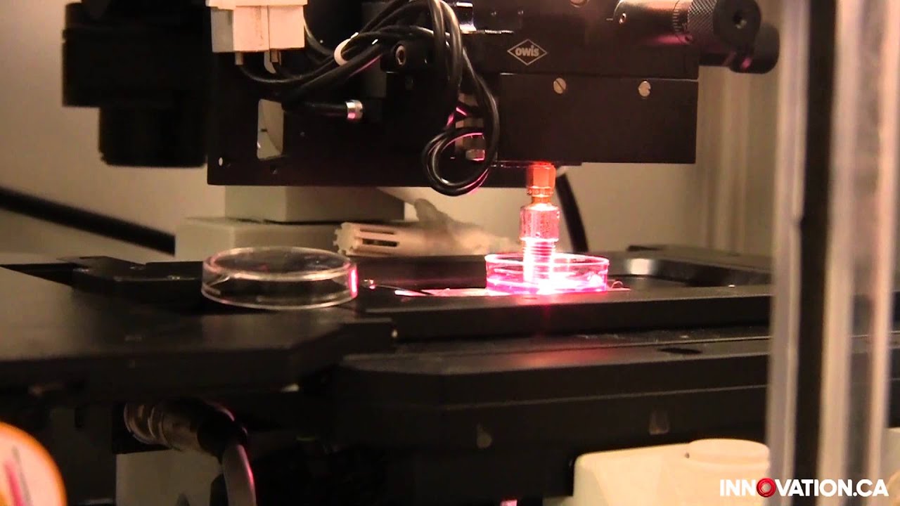 Lights, sound waves, ACTION! – Michael Kolios, Ryerson University - YouTube