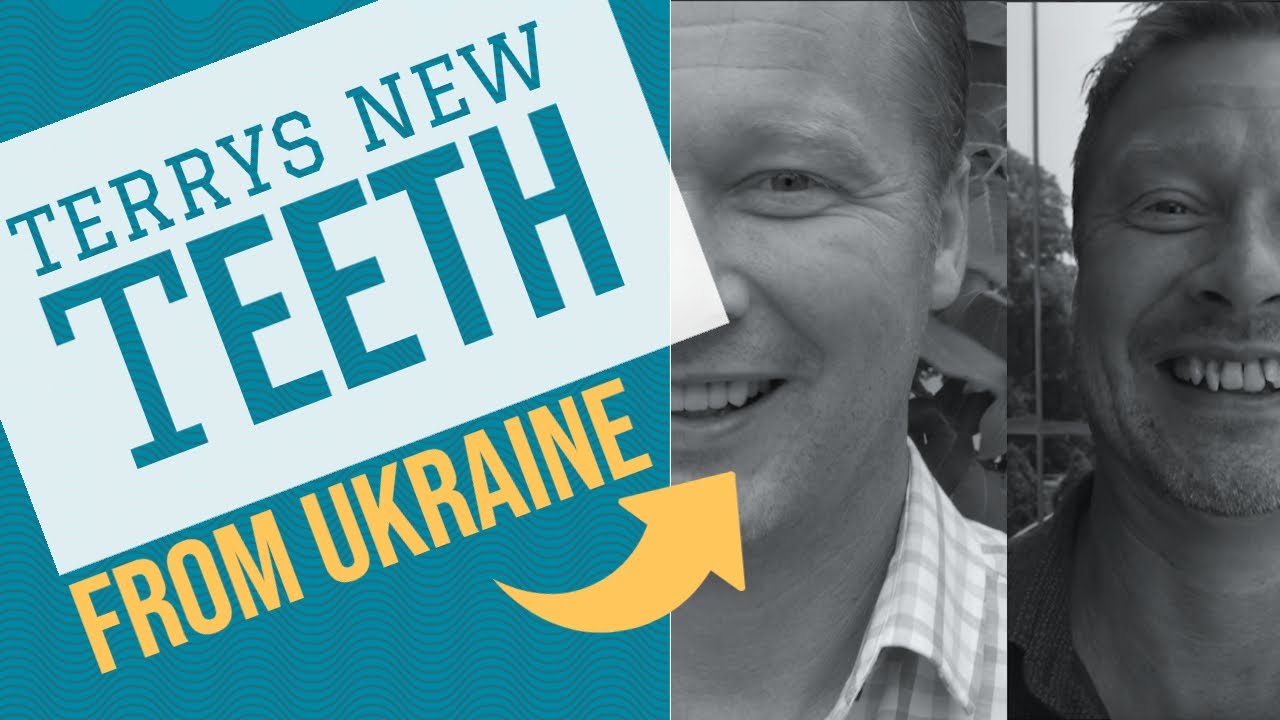 The Results from the Ukraine Dentist. Tery's Teeth - YouTube
