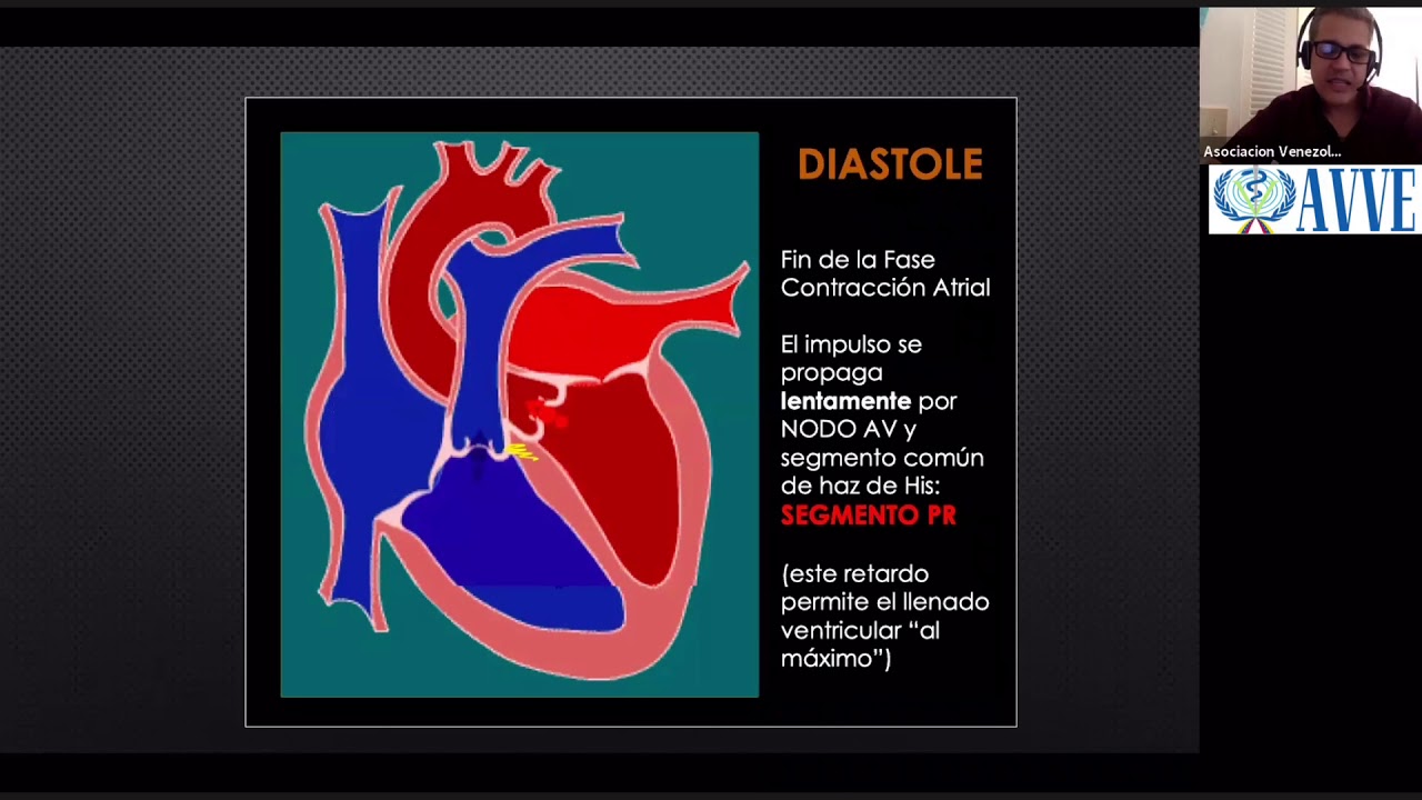 Como leer un electrocardiograma y no morir en el intento. Dr Carlos ...
