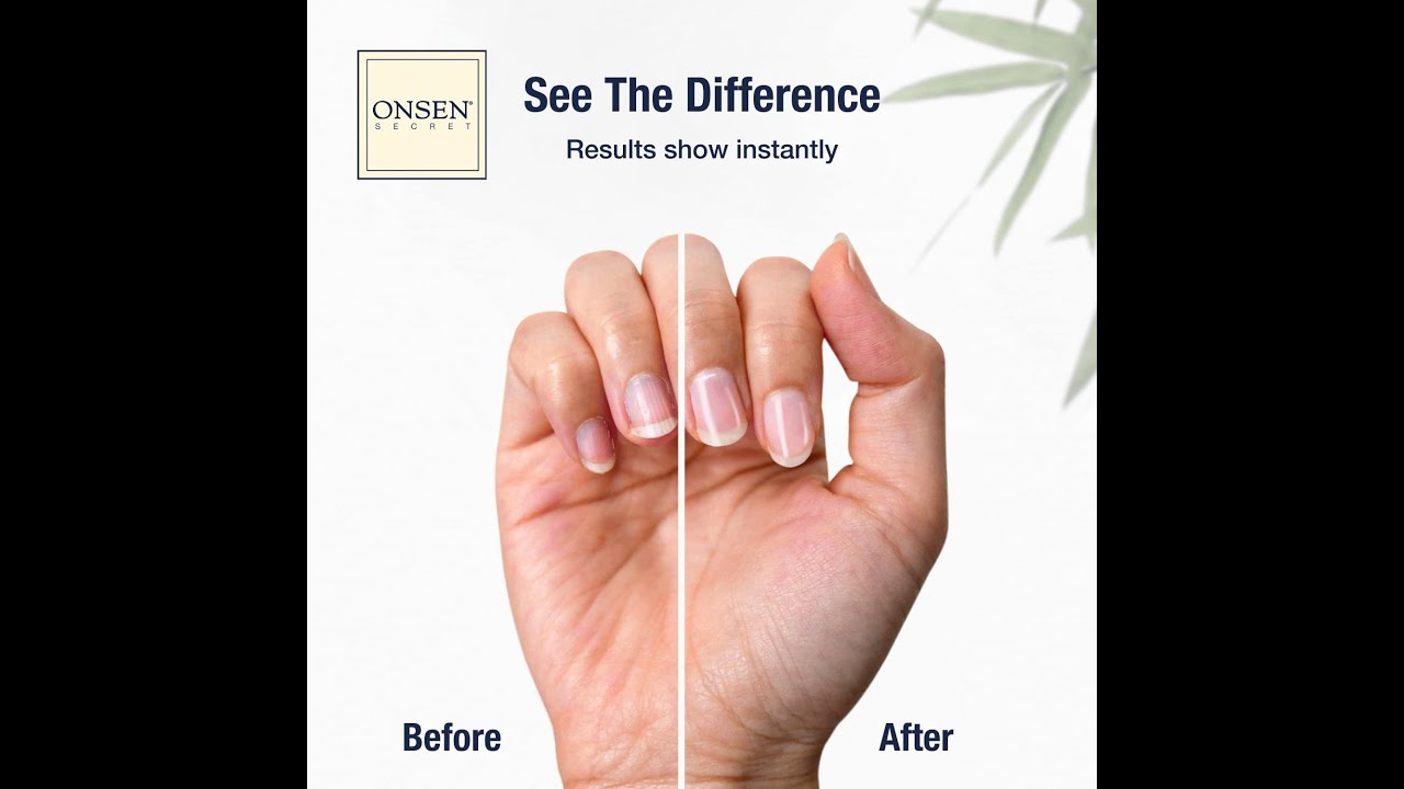 ♨️ Spa-Worthy Nails! Onsen Cuticle Cream & Oil Review (Dry, Cracked ...