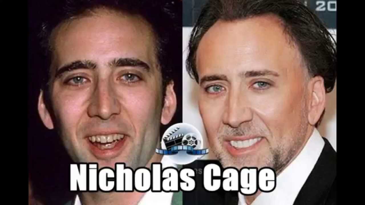 Celebridades Con Dientes Feos