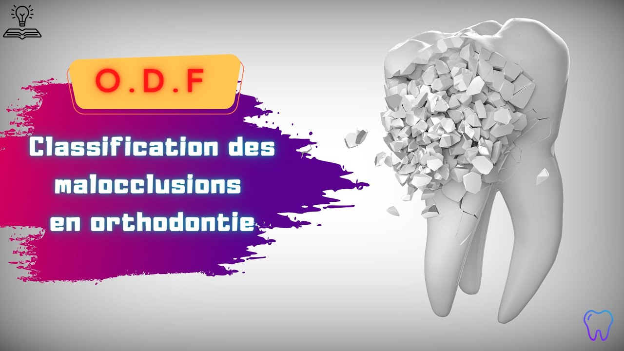 La classification des malocclusions en ODF (ANGLE et BALLARD) - YouTube