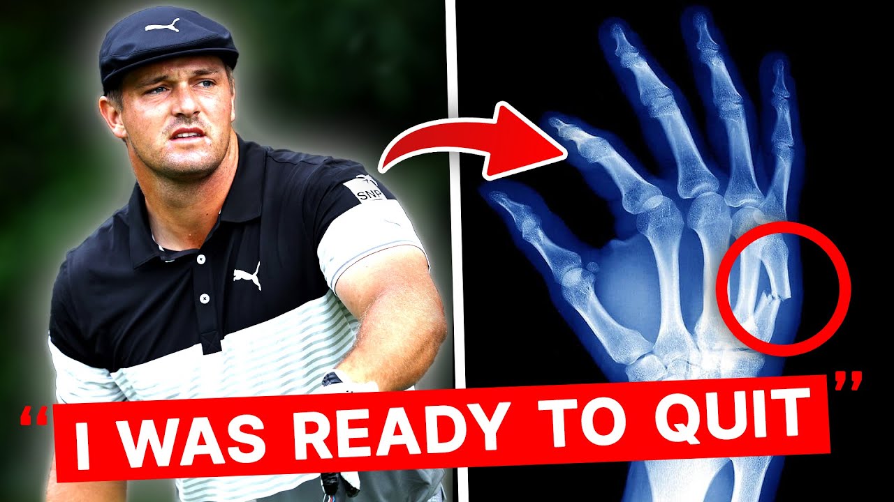 Top 10 SHOCKING injuries that halted a PRO golfer's career - YouTube