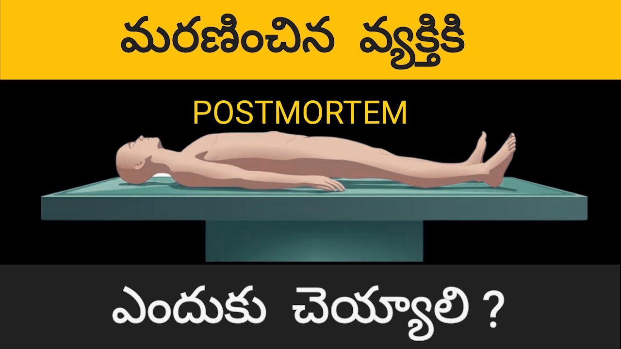 Postmortem Process Full Explaind In Telugu | పోస్ట్ మార్టం | Autopsy | Nammaleni Vinthalu - YouTube