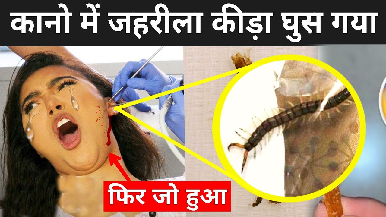 कानो में जहरीला कीड़ा घुस गया फिर जो हुआ | 10 Animals Found Living Inside Humans - YouTube