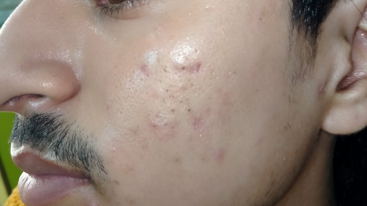 Asghar Barbershop is live! ASMR facial scrub live stream with relax ...