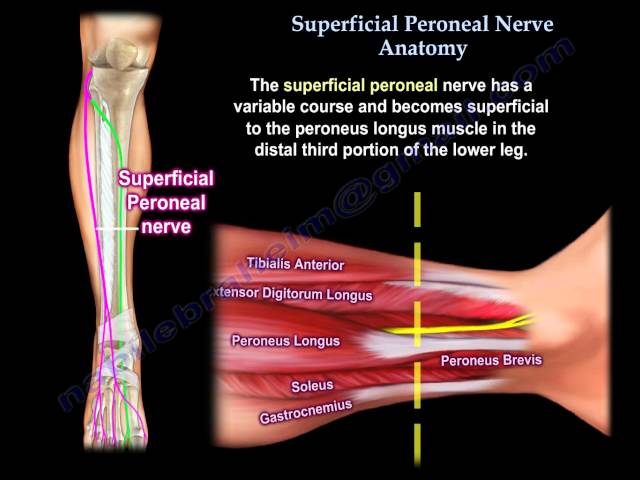 Deep Peroneal Nerve Decompression