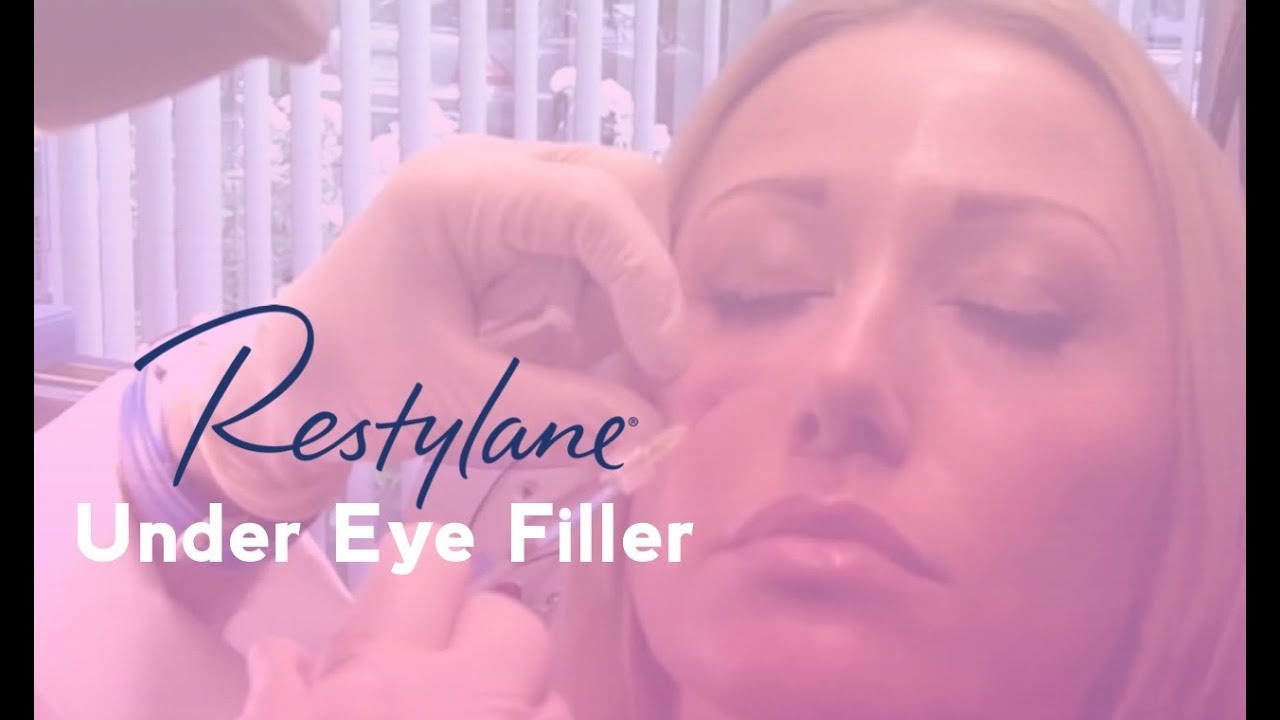 Restylane Under Eye Filler | Total Dermatology - YouTube