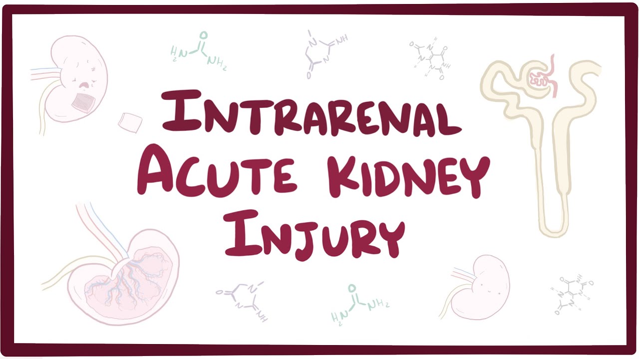 Intrarenal acute kidney injury (acute renal failure) - causes, symptoms ...