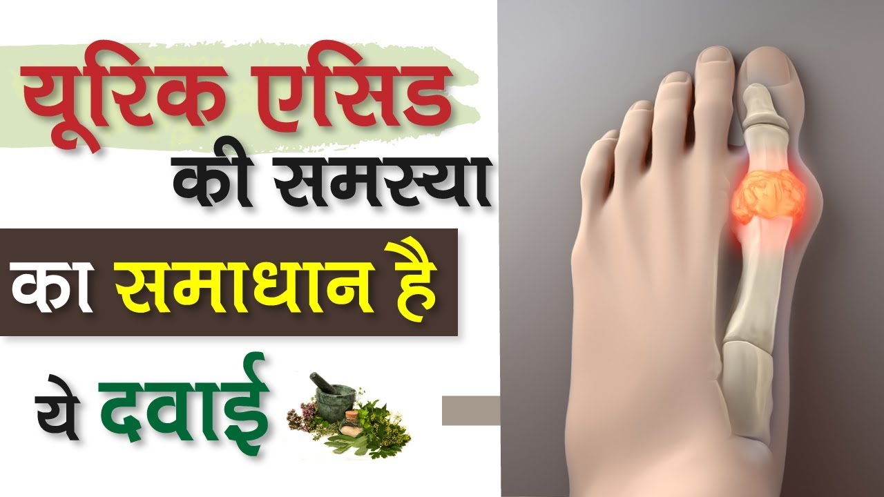 Ayurvedic Medicine in Uric Acid ( Gout ) - यूरिक एसिड का घरेलू नुस्खा ...