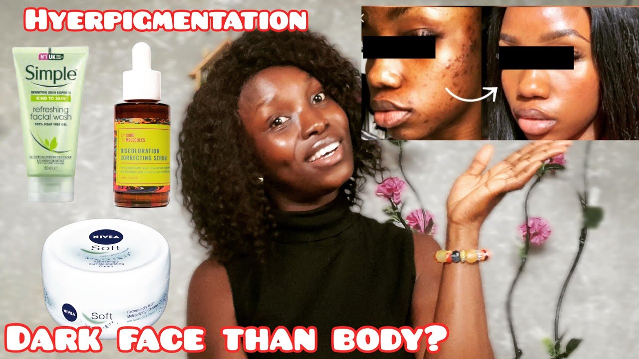 The best routine to lighten your dark spots, dark face and neck!! - YouTube