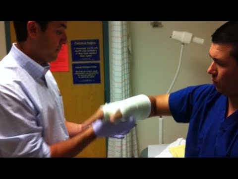 SHORT ARM CAST APPLICATION - YouTube