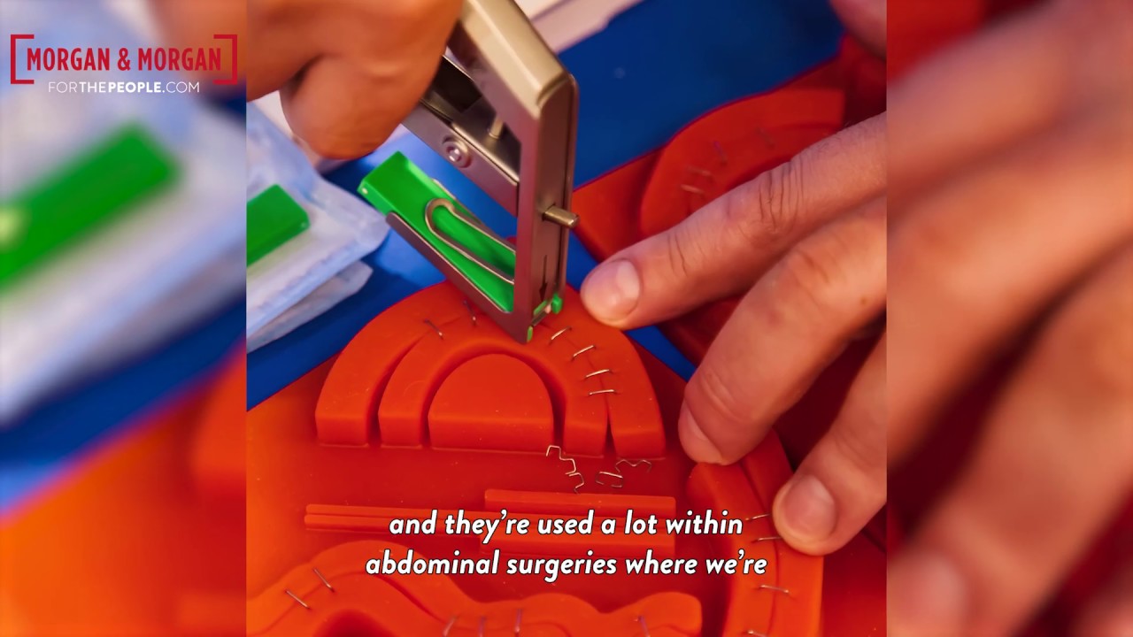 Surgical Staplers: What’s the Risk? | Attorney Mike Morgan - YouTube