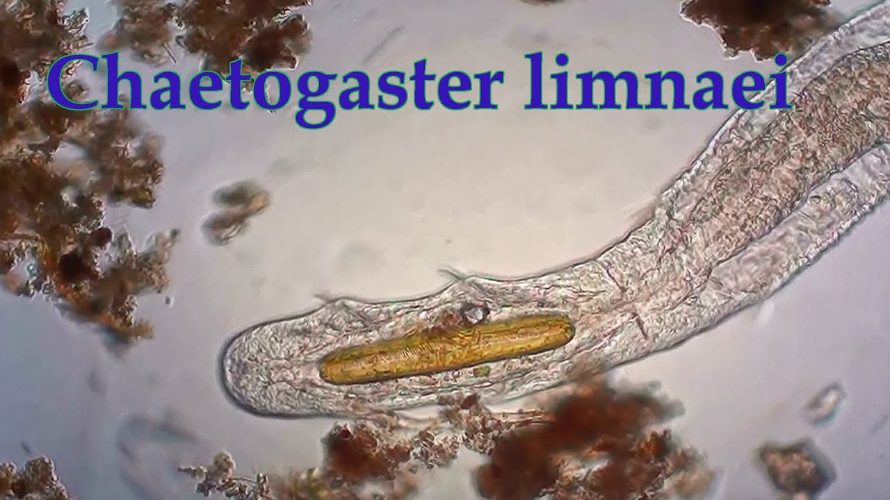 Chaetogaster limnaei - YouTube