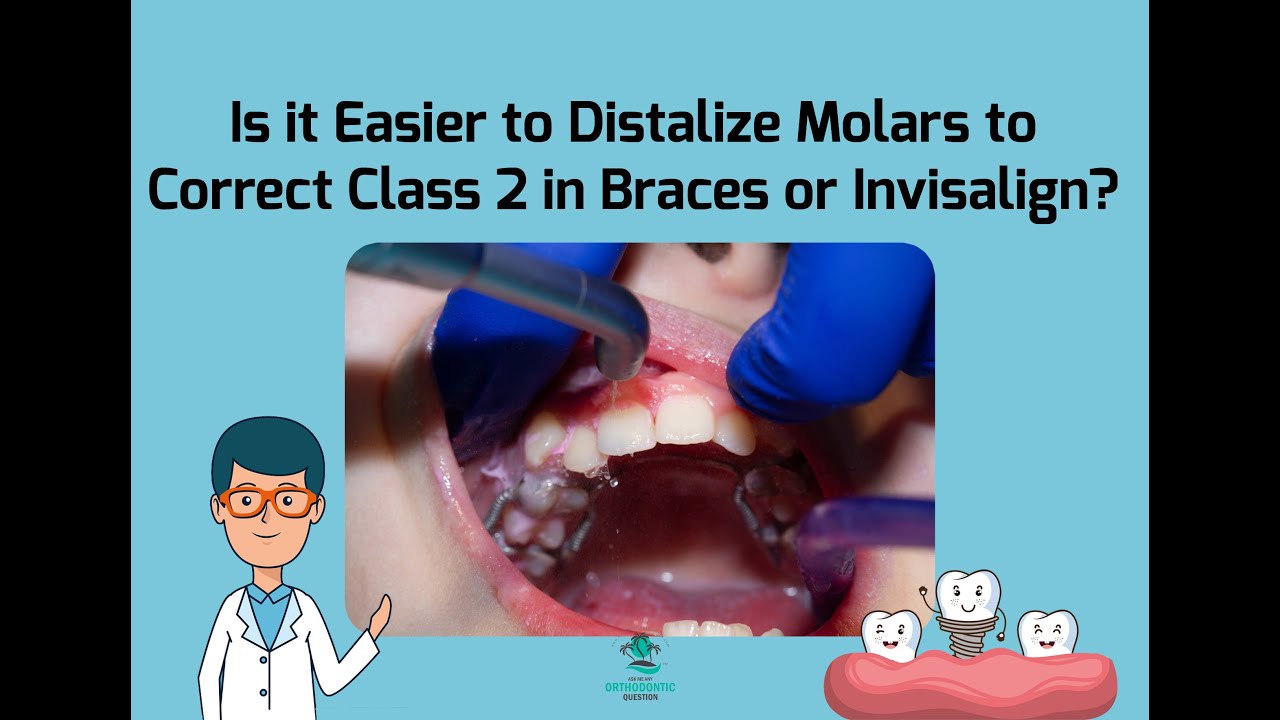 Can you Distalize Molars with Braces Instead of Invisalign to Save ...