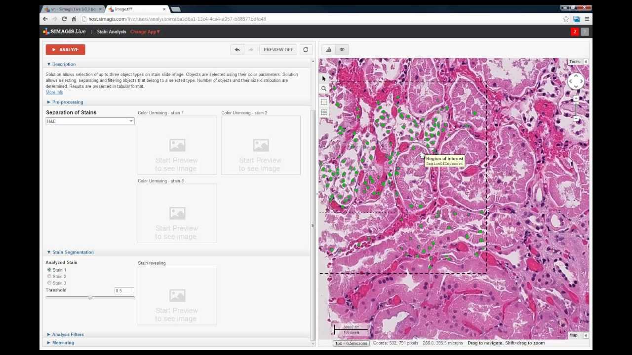 Pathforce Digital Pathology Network - YouTube