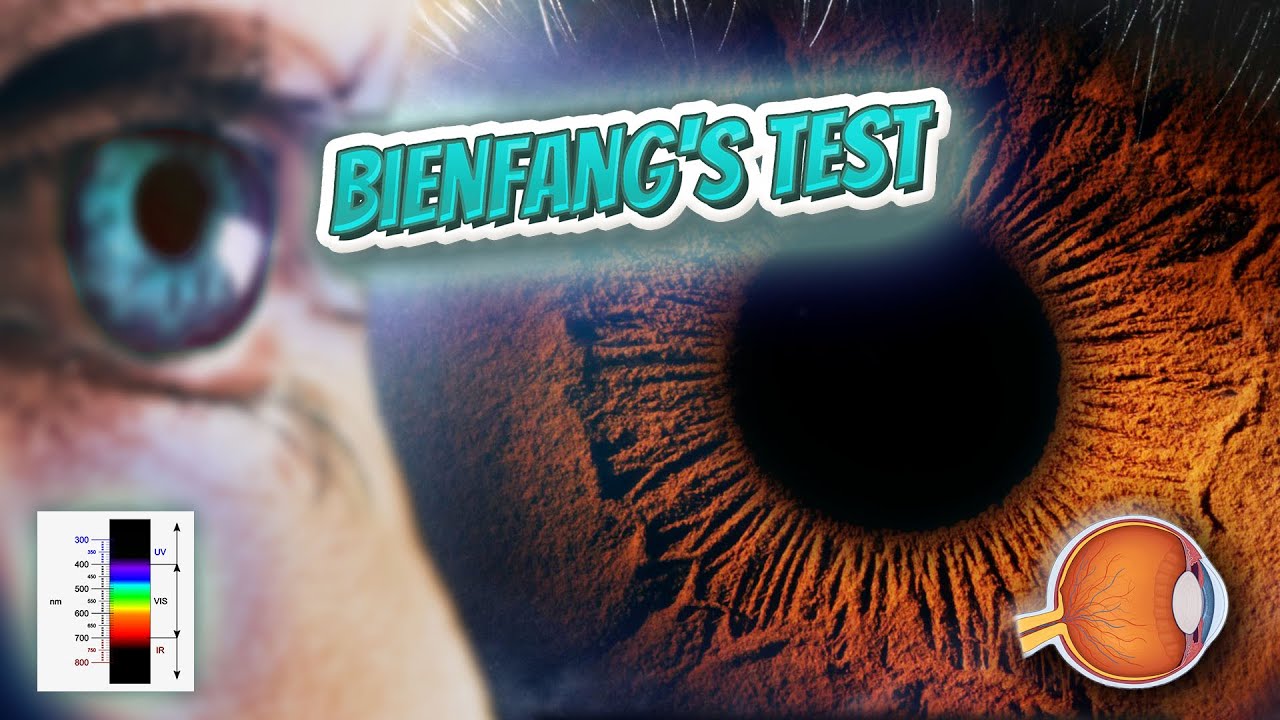 Bienfang's test - Your EYEBALLS - EYNTK 👁️💉😳💊🔊💯 - YouTube