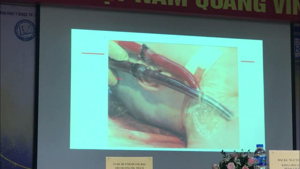 Thành phần hệ thống ECMO - YouTube