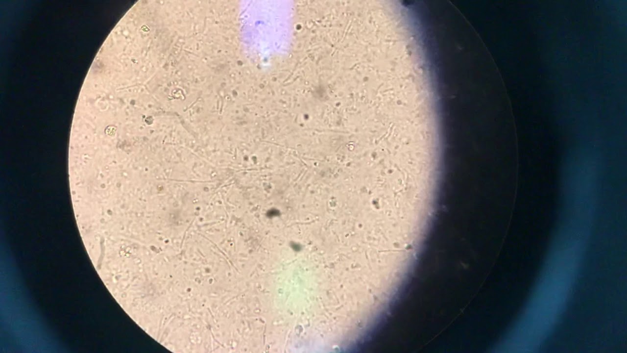 Spirochetes in dog feces - YouTube