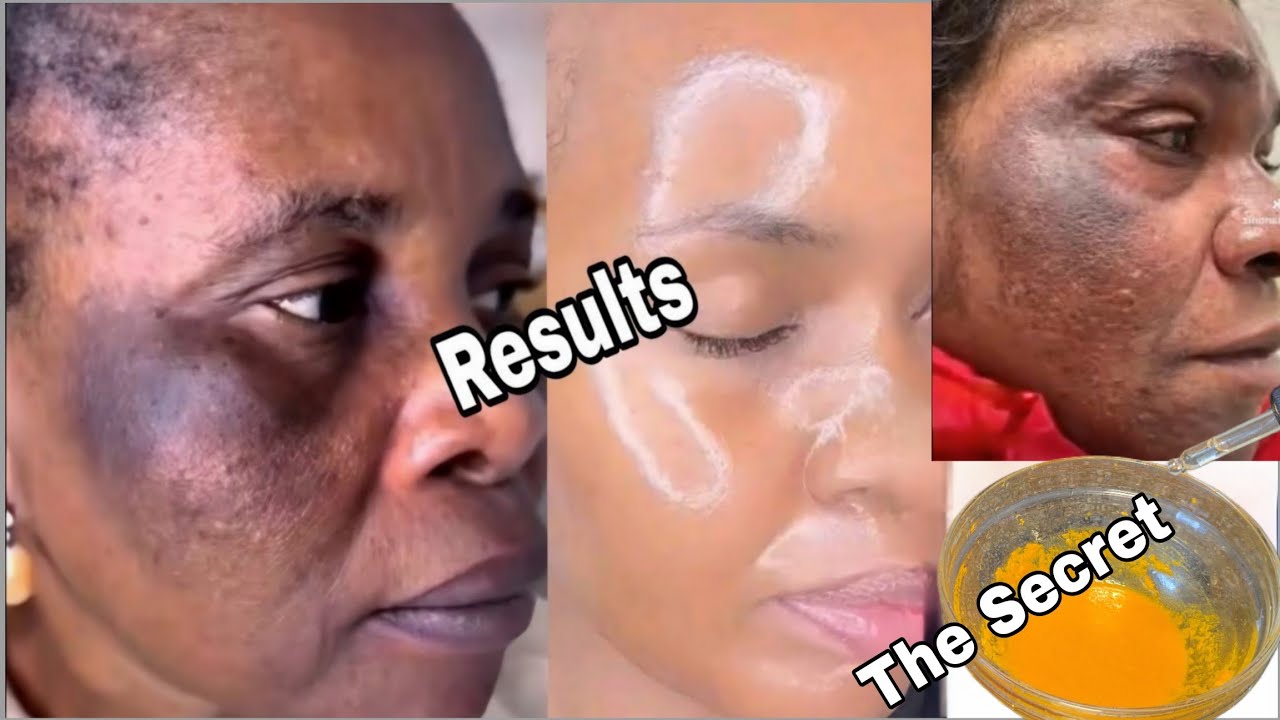 Just mix Coffee this way and your skin will be GOOD again / HOW to ...
