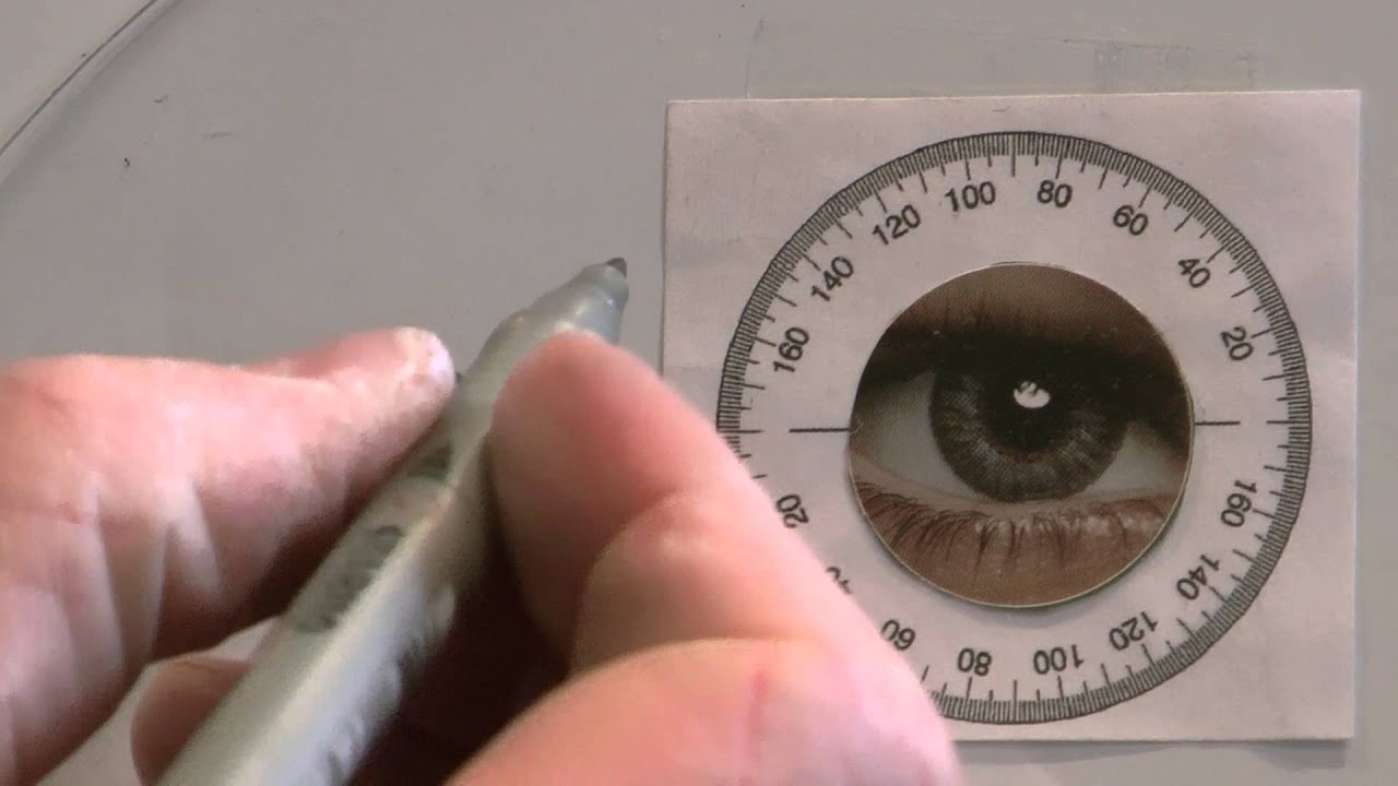 Cross Cyl Refraction Part 2: Subjective Refraction Part 8 - YouTube