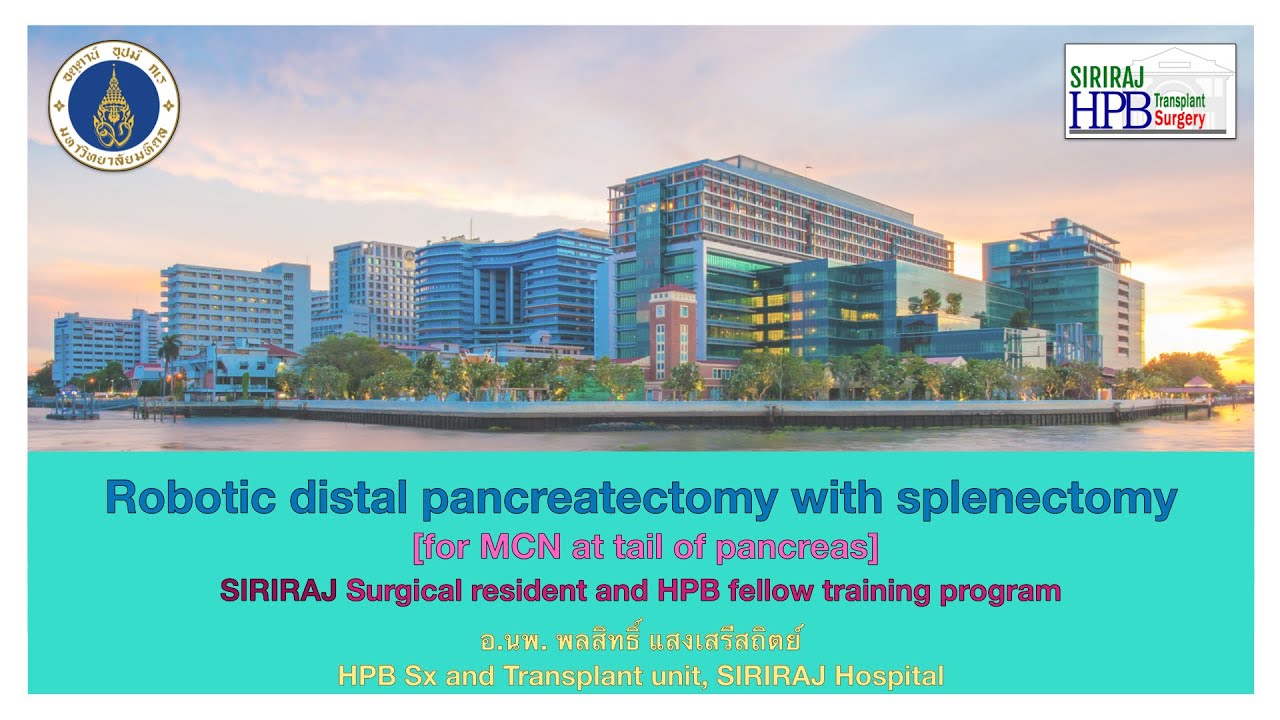 How I do it : Robotic distal pancreatectomy with splenectomy ...
