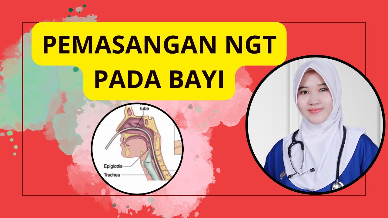 PEMASANGAN NGT PADA BAYI - YouTube