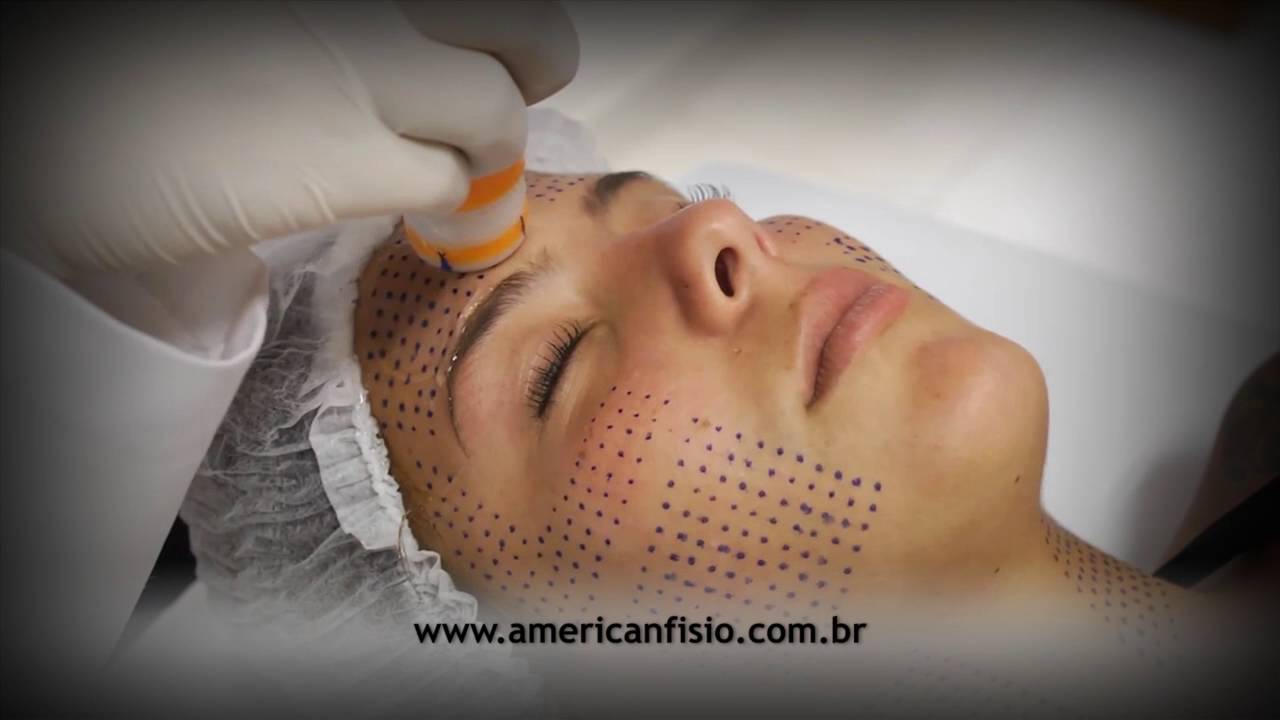 ULTRAFOCUS HTM - YouTube