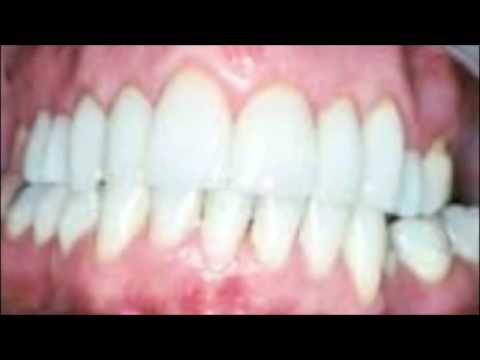 LVI Smile Cosmetic Dentists 9 - YouTube