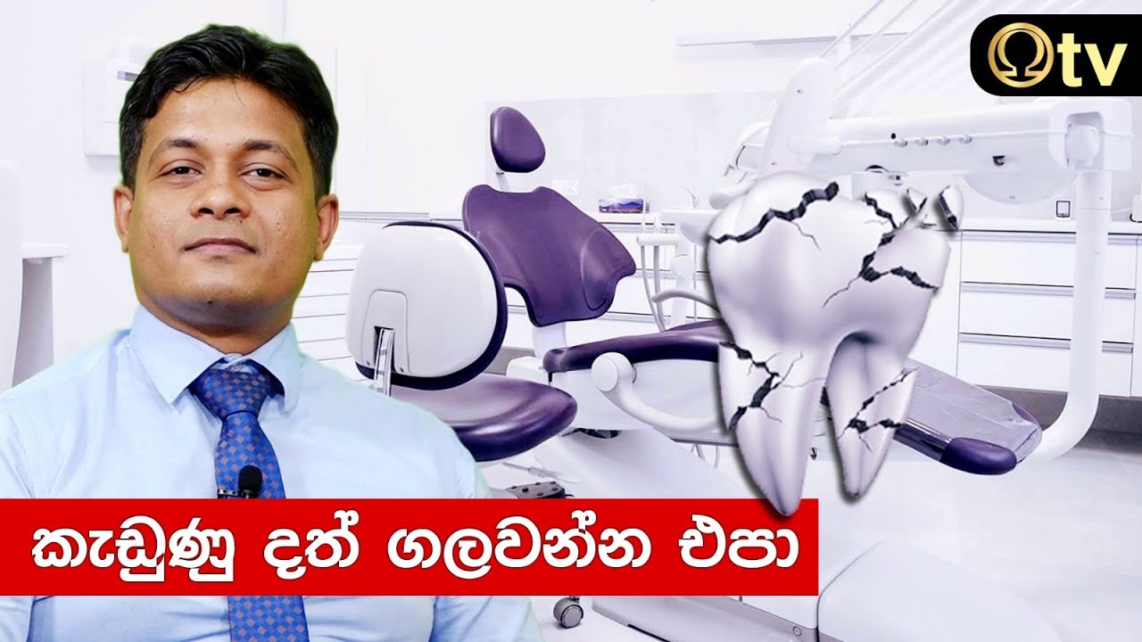කැඩුණු දත් ගලවන්න එපා - Dr. Chanaka Dissanayake - OTV - YouTube