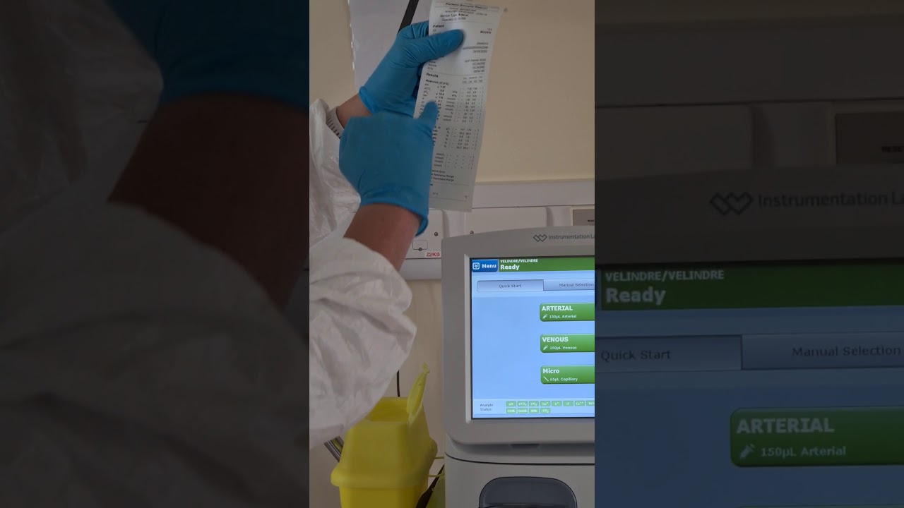 New Blood Gase Machine - GEM 5000 - YouTube