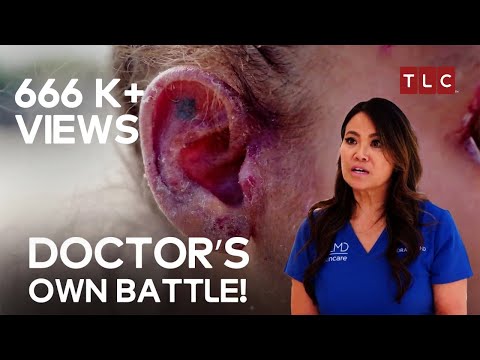 A Dermatologist’s Personal Fight! | Dr Pimple Popper TLC