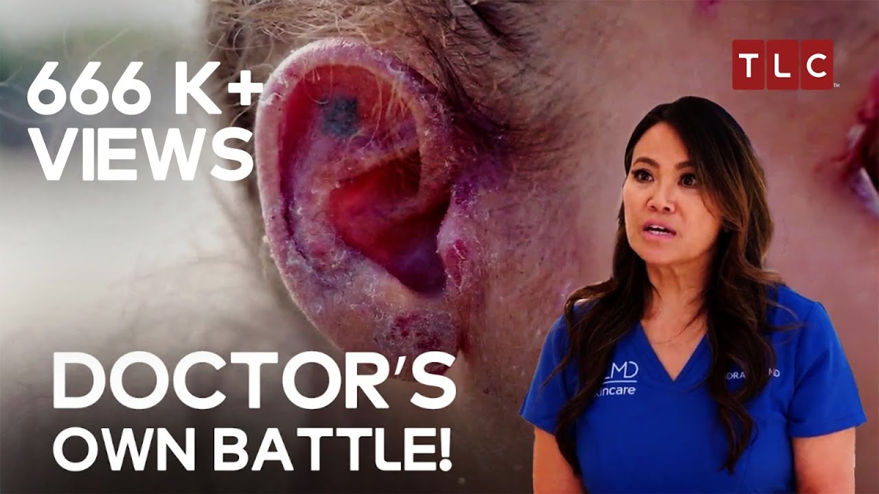 A Dermatologist’s Personal Fight! | Dr Pimple Popper TLC - YouTube